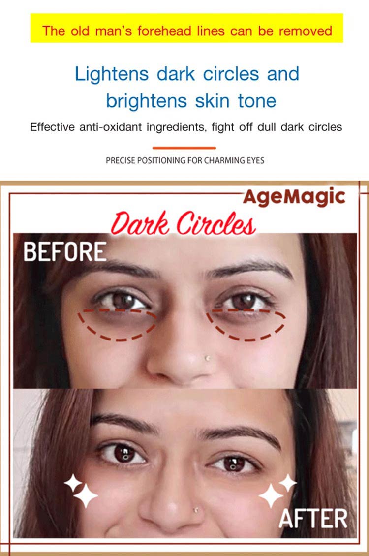 Astaxanthin Caviar Eye Cream-Fades Eye Wrikles/Dark Circles/Eye Bags